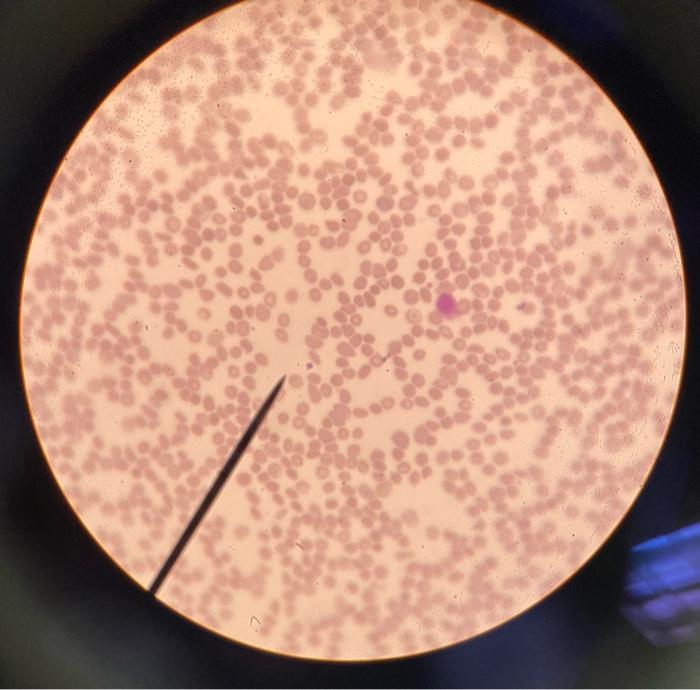 Solved Draw the images of the blood cells as they appear | Chegg.com