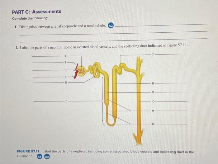 Solved 1. Distinguish between a renal corpuscle and a renal | Chegg.com