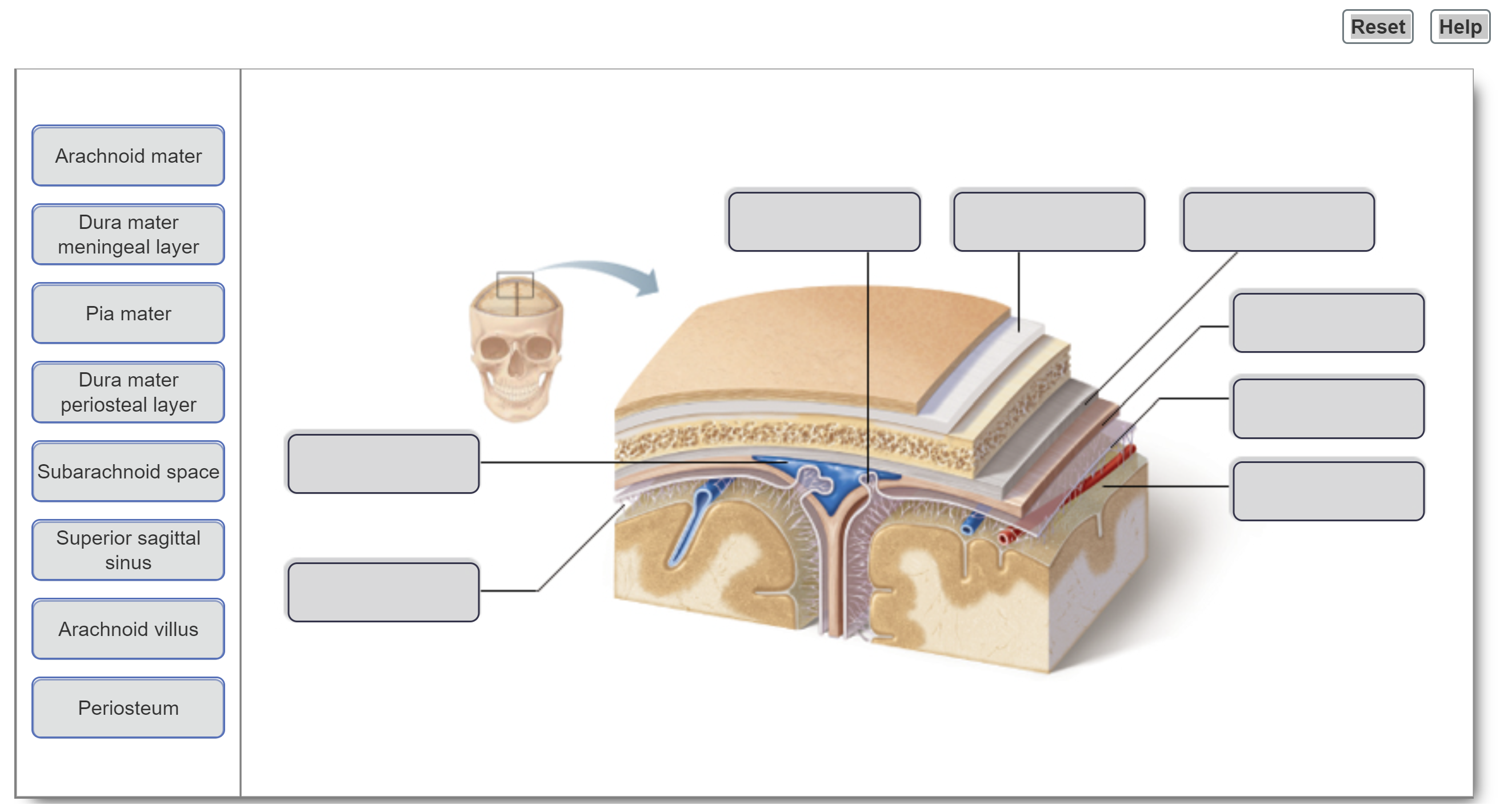 Solved Arachnoid materDura mater meningeal layerPia | Chegg.com