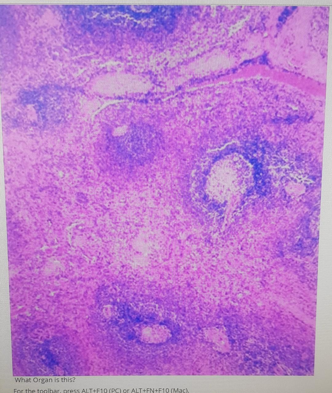 Solved what organ is this? | Chegg.com