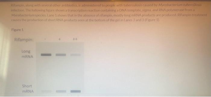 Solved consider now prokaryouc transcription occurs. | Chegg.com