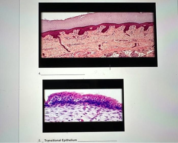 Solved 5. Transitional Epithelium8. cartilage 9. Connective | Chegg.com