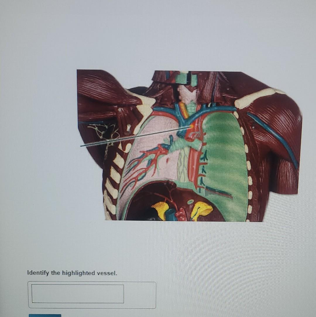 Solved Identify the highlighted vessel. | Chegg.com