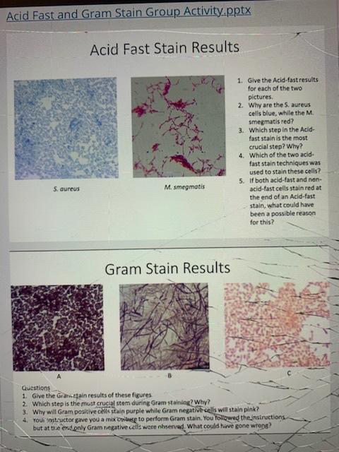 Solved Acid Fast and Gram Stain Group Activity.pptx Acid | Chegg.com