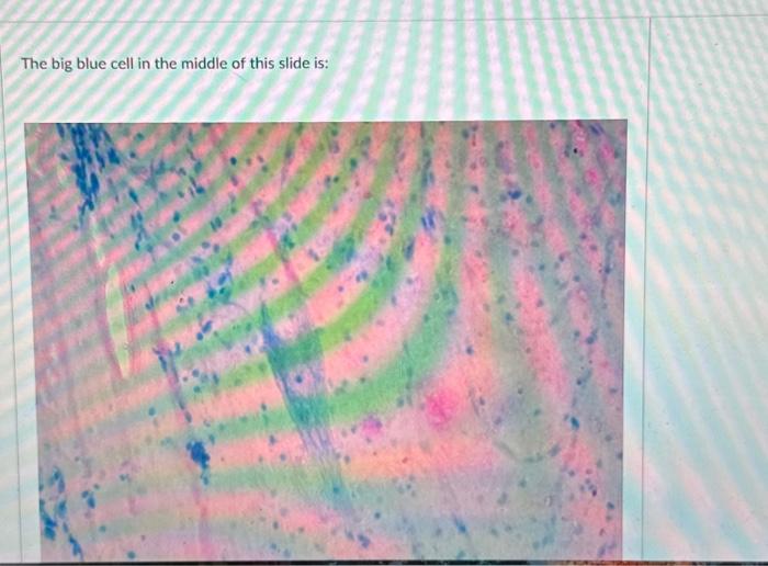 Solved The big blue cell in the middle of this slide is: A | Chegg.com