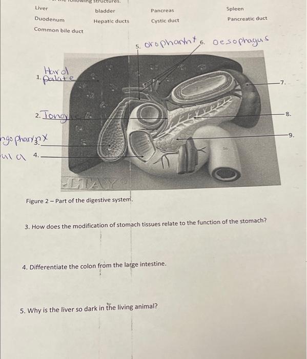 Solved structures Liver bladder Pancreas Spleen Duodenum | Chegg.com