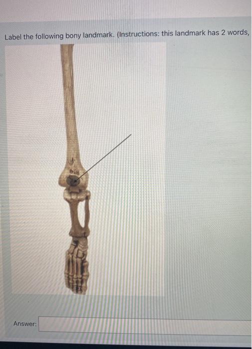 Solved Label the following bony landmark. (Instructions: | Chegg.com