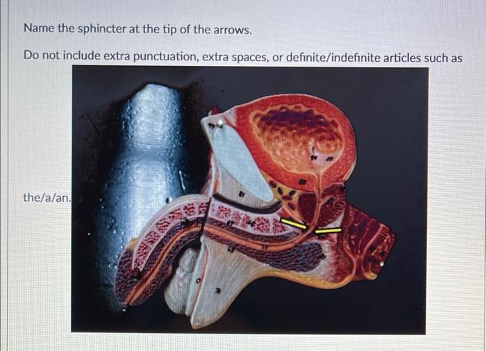 Solved Name the specific structure identified by the tip of | Chegg.com