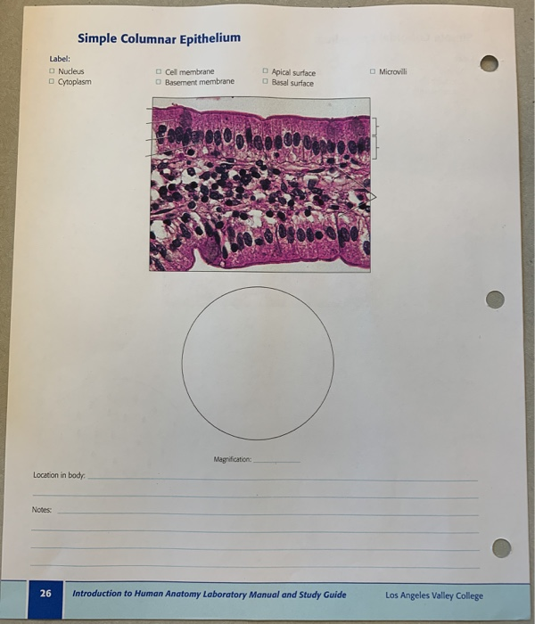 Solved Simple Squamous Epithelium Label: Nucleus Cytoplasm | Chegg.com