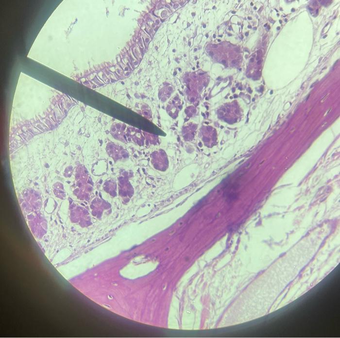 Solved Question 3: When you summarize the results of an | Chegg.com