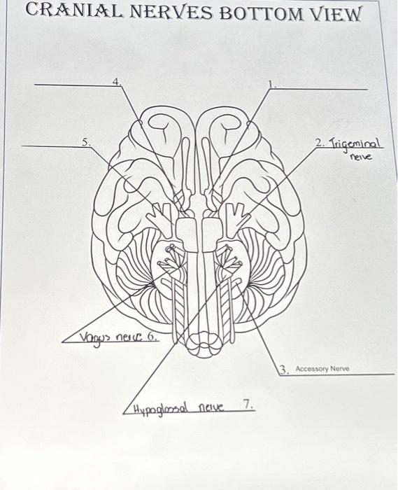 Solved CRANIAL NERVES BOTTOM VIEW | Chegg.com