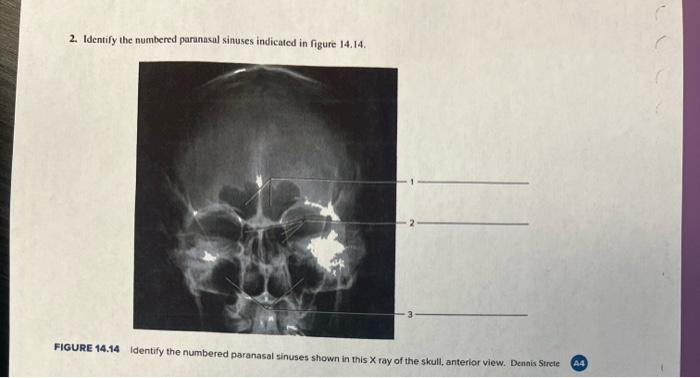 2. Identify the numbered paranasul sinuses indicated | Chegg.com