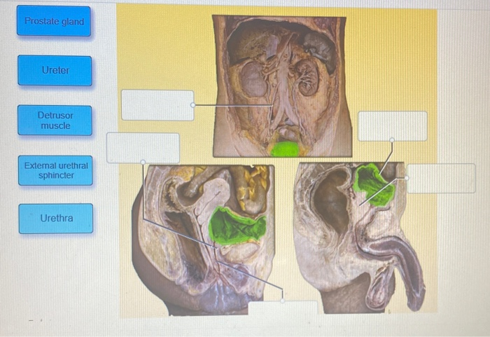Solved Prostate gland Ureter Detrusor muscle External | Chegg.com