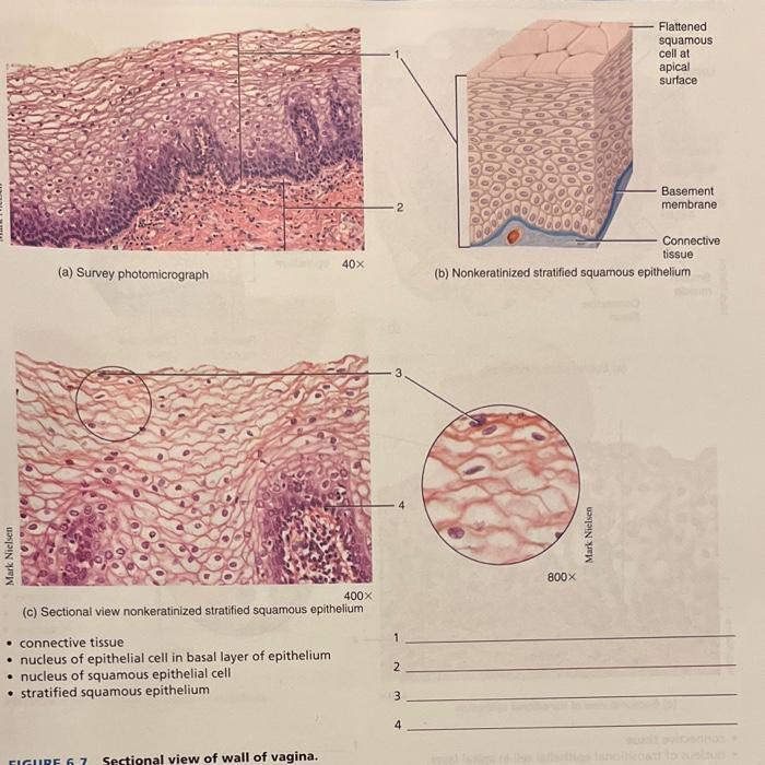 Epithelial Nonkeratinized Stratified Squamous Cell Stratified Squamous