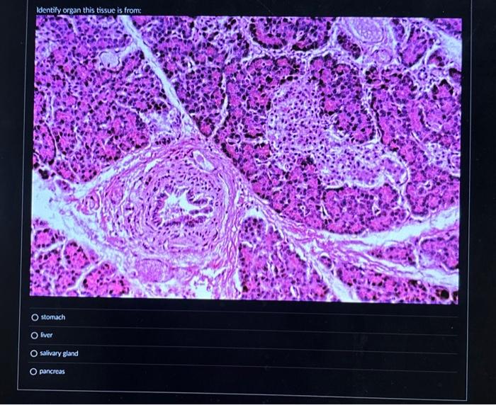 Solved Identify organ this tissue is from: stomach liver | Chegg.com
