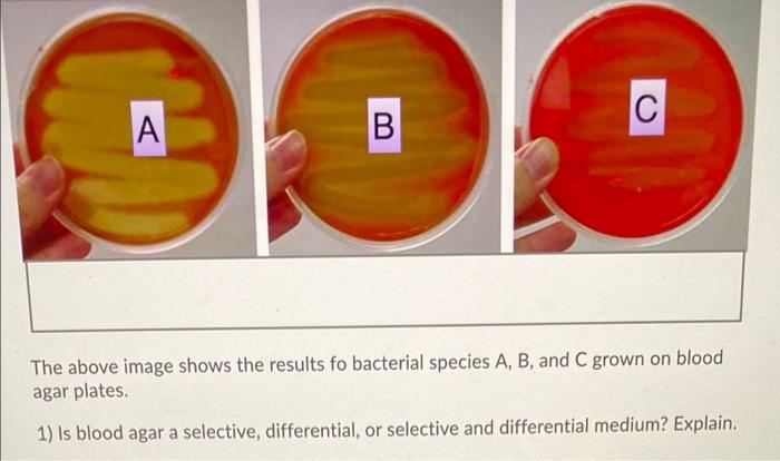 Solved Bacteria are grown on culture media in the lab. Agar | Chegg.com