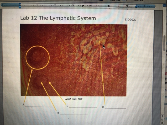 Solved S H 6 Lab 12 The Lymphatic System BIO202L es Lymph | Chegg.com