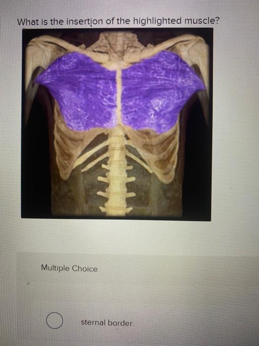 Solved What is the insertion of the highlighted muscle? | Chegg.com
