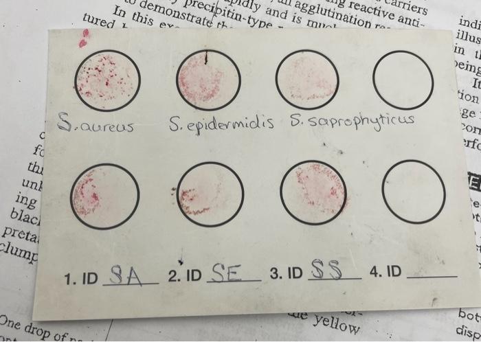 Solved EXERCISE 56 Slide Agglutination (Latex) Test: For S. | Chegg.com