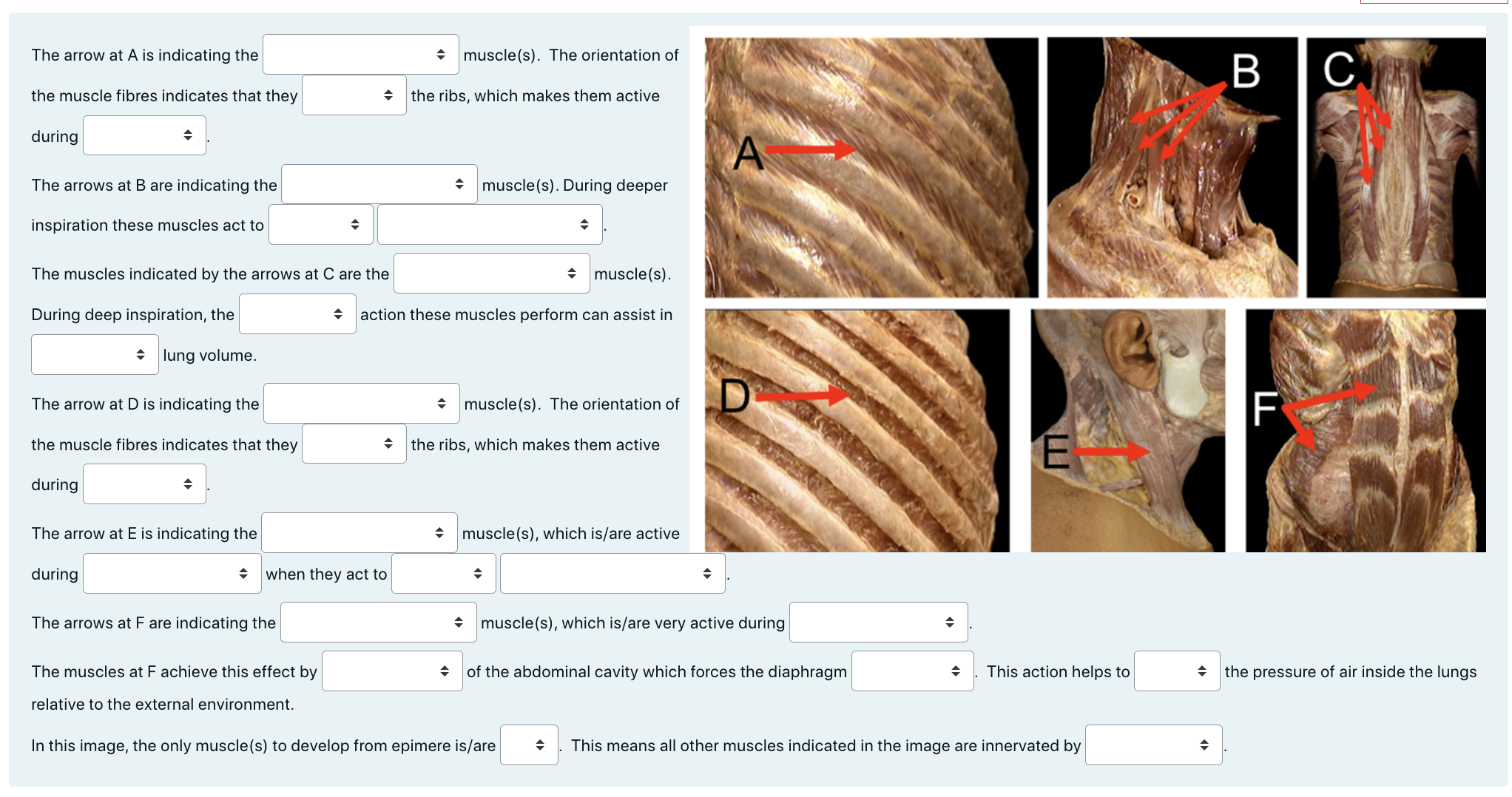 Solved The arrow at A ﻿is indicating the ﻿muscle(s). ﻿The | Chegg.com