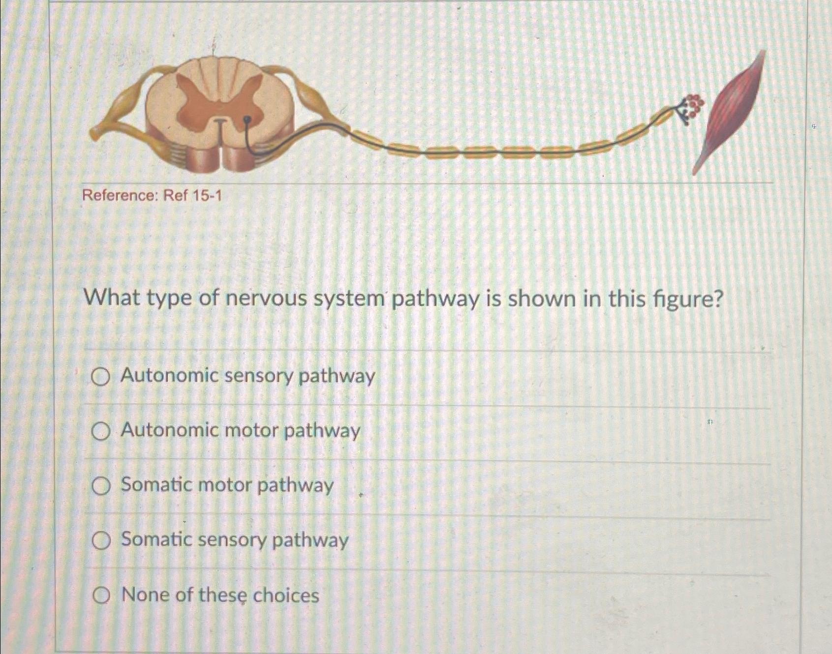 Solved Reference: Ref 15-1What type of nervous system | Chegg.com