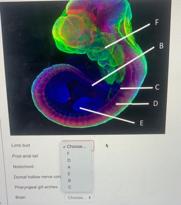 Solved On this image of a developing mouse embryo, match the | Chegg.com