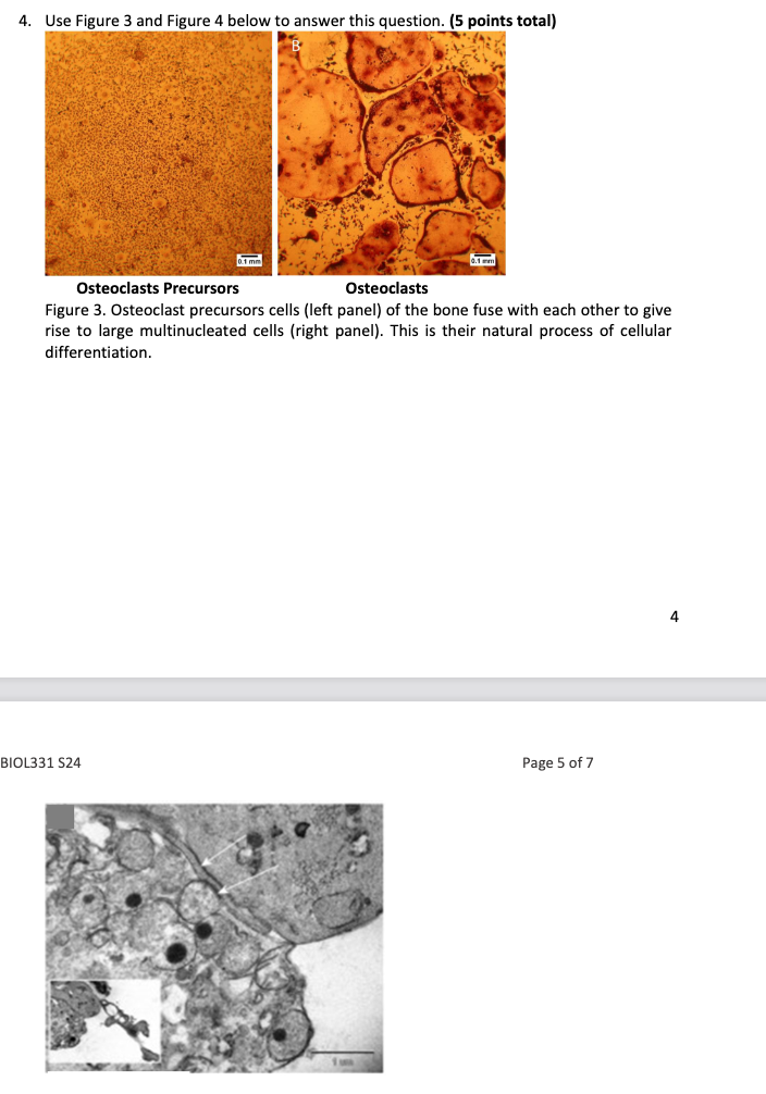 Solved Osteoclasts PrecursorsOsteoclastsFigure 3. | Chegg.com