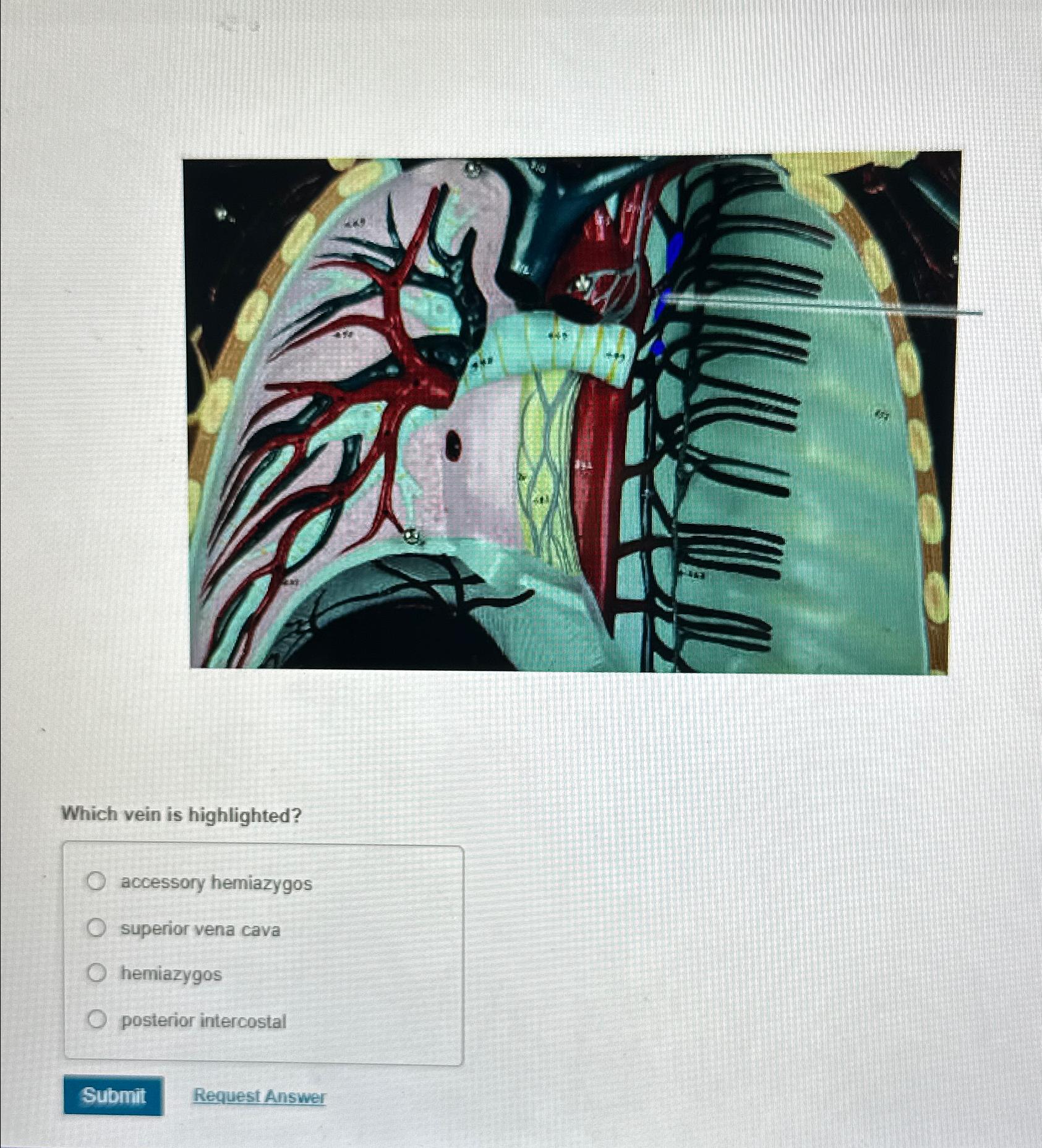 Solved Which vein is highlighted?accessory | Chegg.com