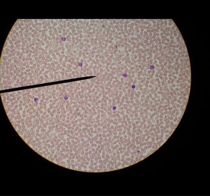 White Blood Cells Slide Labeled