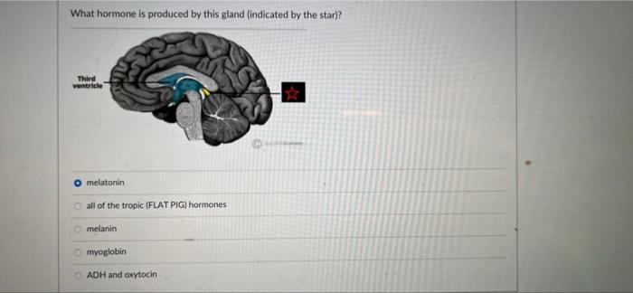 Solved What hormone is produced by this gland (indicated by | Chegg.com