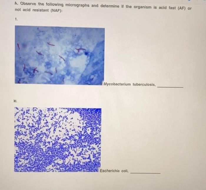 Solved A. Observe the following micrographs and determine if | Chegg.com Solved A. Observe the following micrographs and determine if | Chegg.com