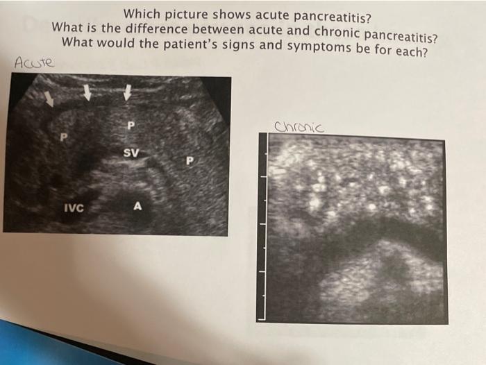 Solved Discuss the vasculature landmarks associated with the | Chegg.com