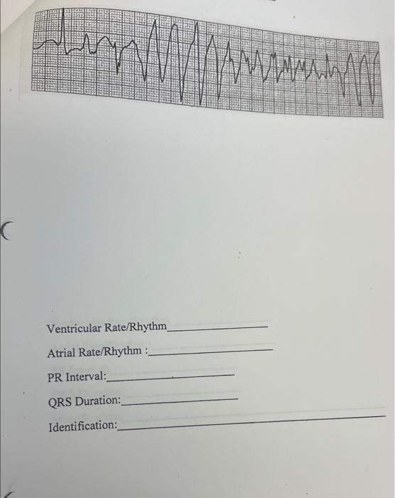 Ventricular Rate/Rhythm Atrial Rate/Rhythm : PR | Chegg.com