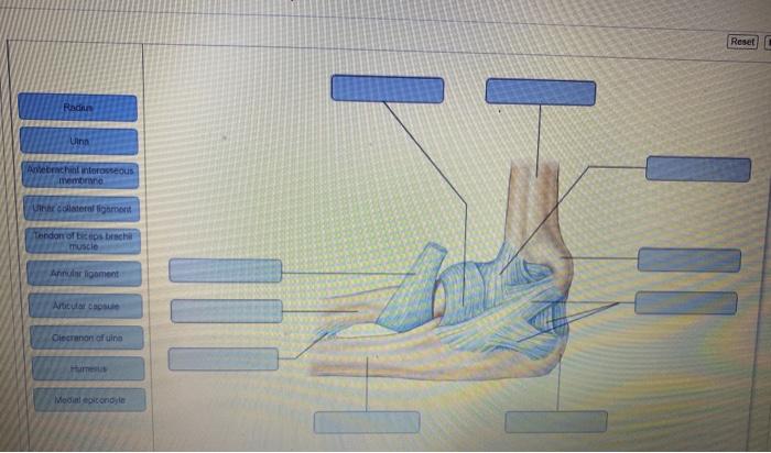 Solved Art-labeling Activity: The right elbow joint (lateral | Chegg.com