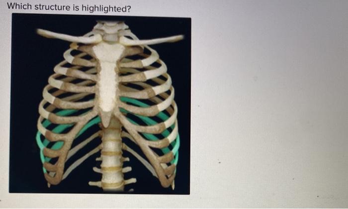 Solved Which structure is highlighted? Multiple Choice | Chegg.com