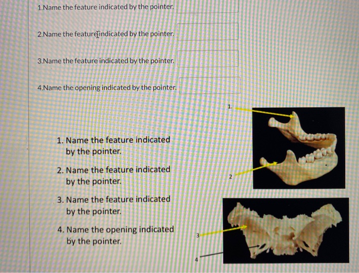 Solved 1.Name the feature indicated by the pointer. 2.Name | Chegg.com