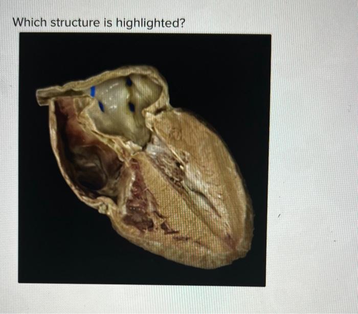 Solved Which structure is highlighted? Multiple Choice | Chegg.com