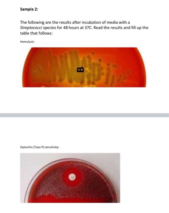Solved The following are the results after incubation of | Chegg.com