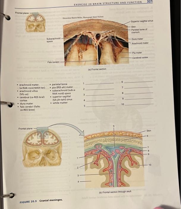 Solved 321 EXERCISE 20 BRAIN STRUCTURE AND FUNCTION Frontal | Chegg.com
