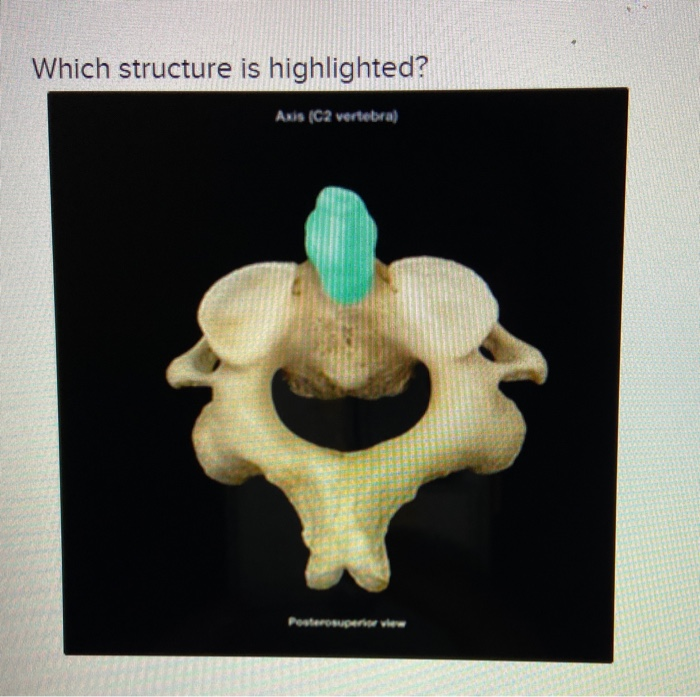 Solved Which structure is highlighted? Axis (C2 vertebra) | Chegg.com