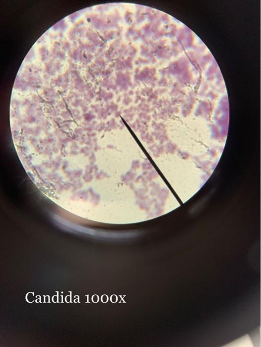 Solved Penicillium 1000x Saccharomyces
