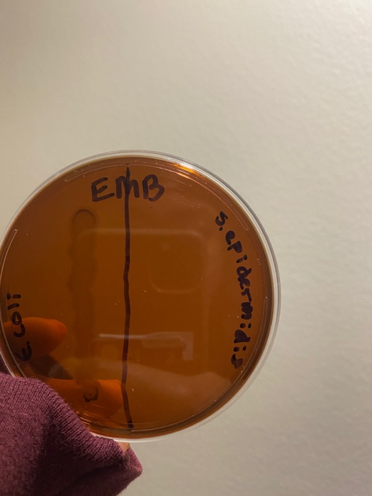 Solved B. Describe the Escherichia coli and the | Chegg.com