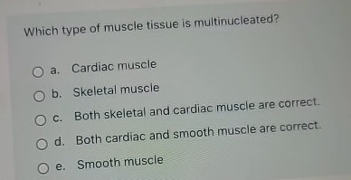 Solved Which type of muscle tissue is multinucleated?a. | Chegg.com