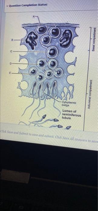 Solved Question Completion Status: Basal compartment D | Chegg.com