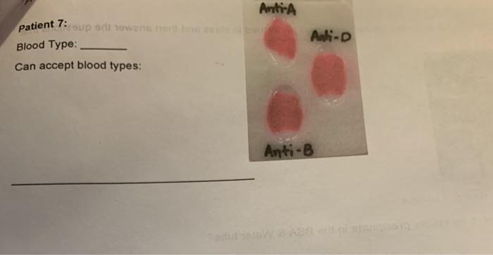 Solved What is the blood type of Patient 7 and what blood | Chegg.com
