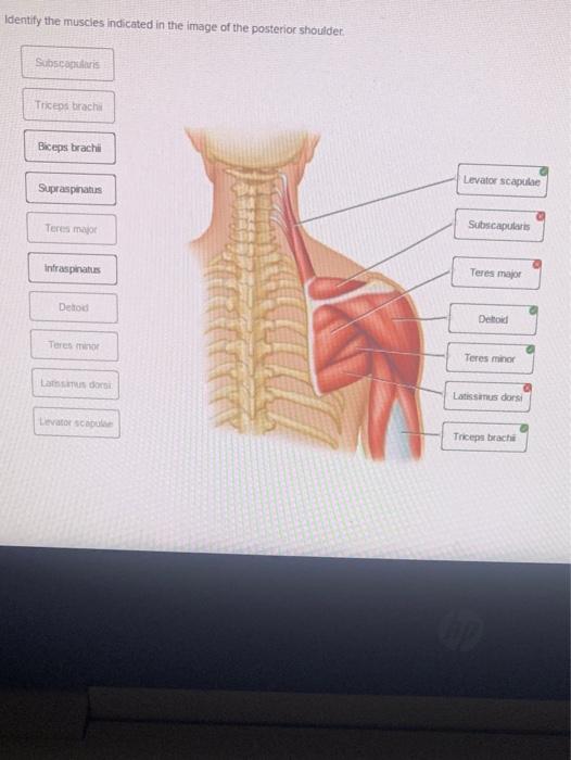 Solved Identify the muscles indicated in the image of the | Chegg.com