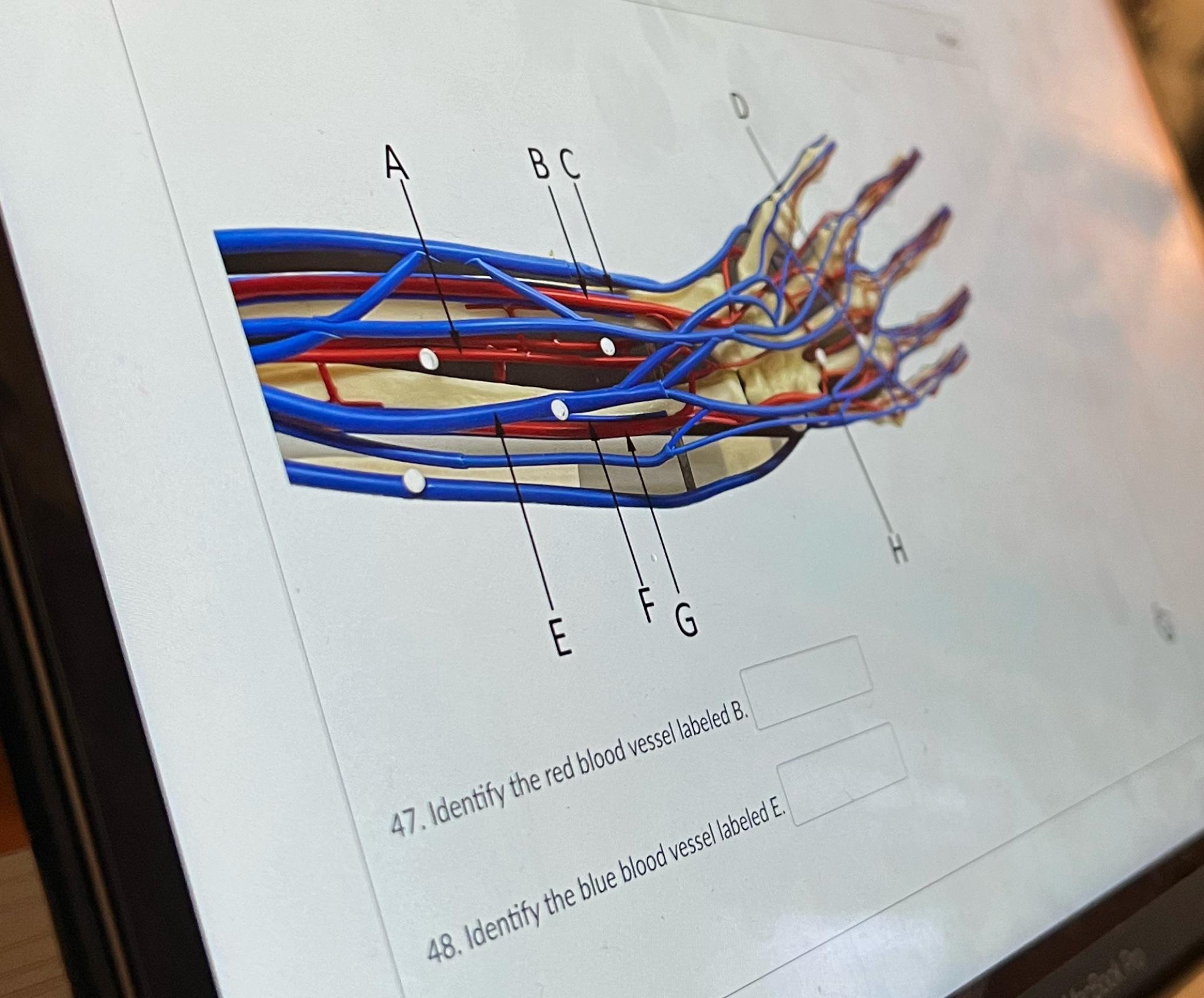 Solved Identify the red blood vessel abeled B.Identify the | Chegg.com