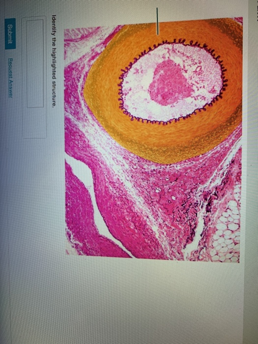 Solved Identify the highlighted vessel. Submit Request | Chegg.com