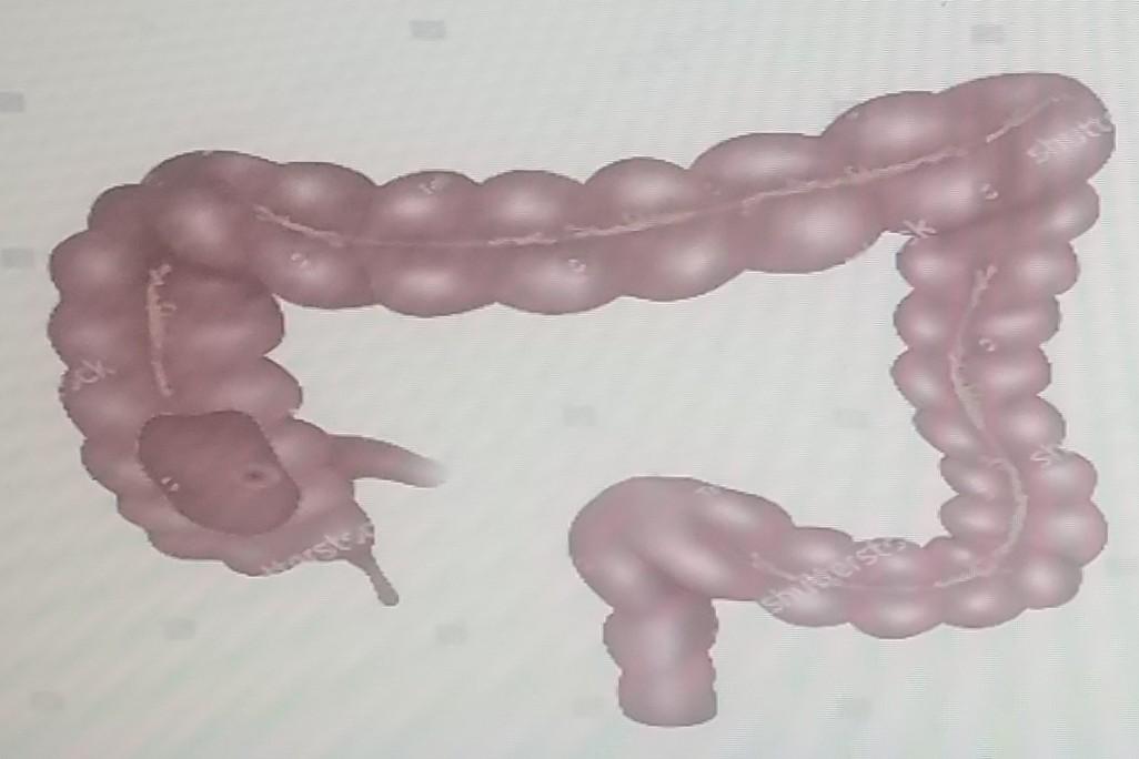 Solved Label Parts of Large Intestine: Appendix, Cecum, | Chegg.com