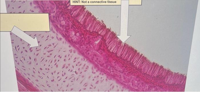 Solved Identify the tissues | Chegg.com Solved Identify the tissues | Chegg.com